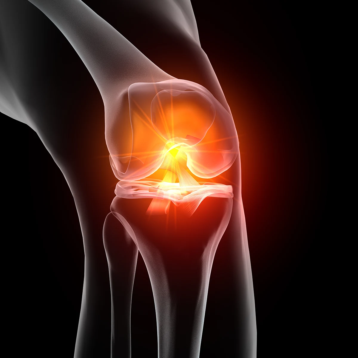 Knee Replacement Dr Paul Miano